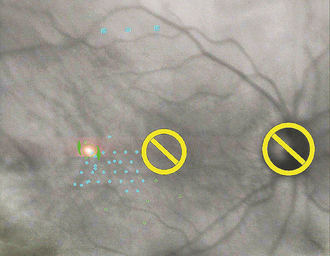 Navilas® 577s Prime - Οφθαλμολογική Μονάδα Ημερήσιας Νοσηλίας